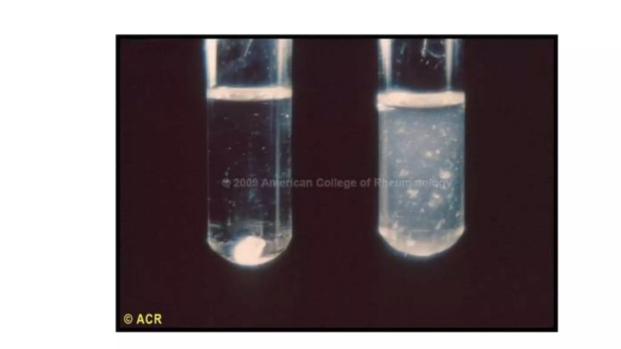 Examination of Body Fluids - Pathology - MLT, ATOT, RDT | PPTX