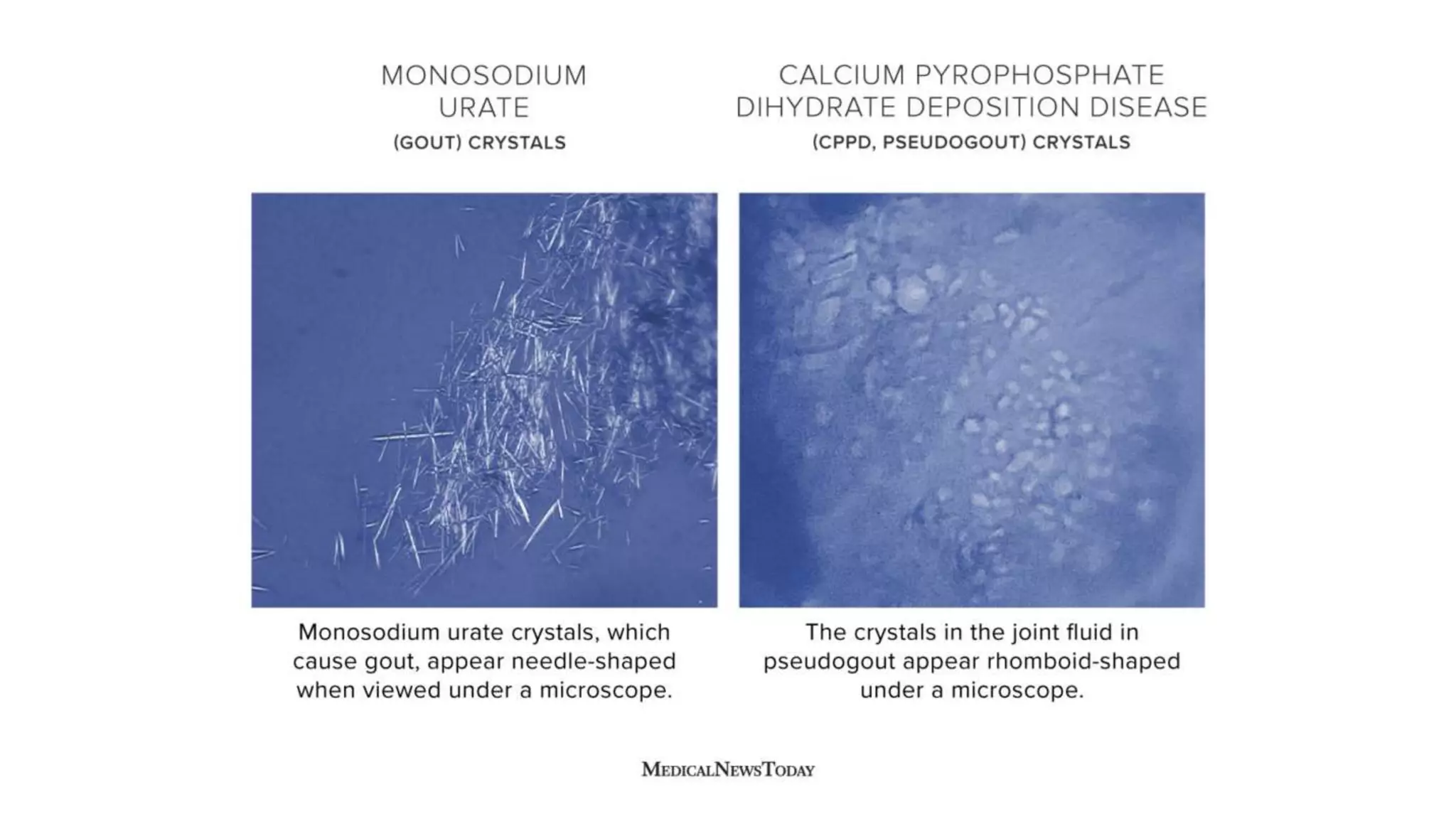 Examination of Body Fluids - Pathology - MLT, ATOT, RDT | PPTX