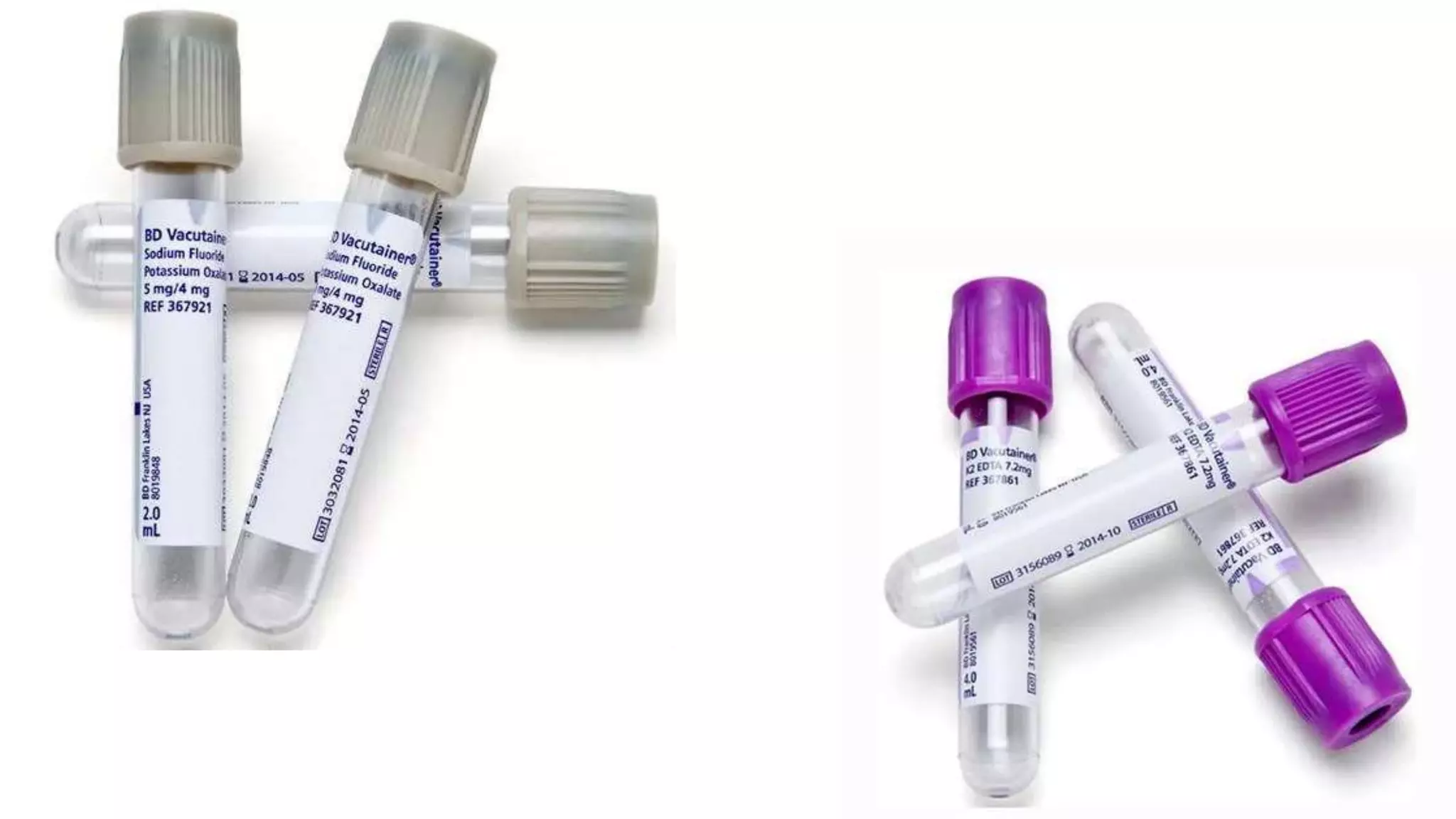 Examination of Body Fluids - Pathology - MLT, ATOT, RDT | PPTX