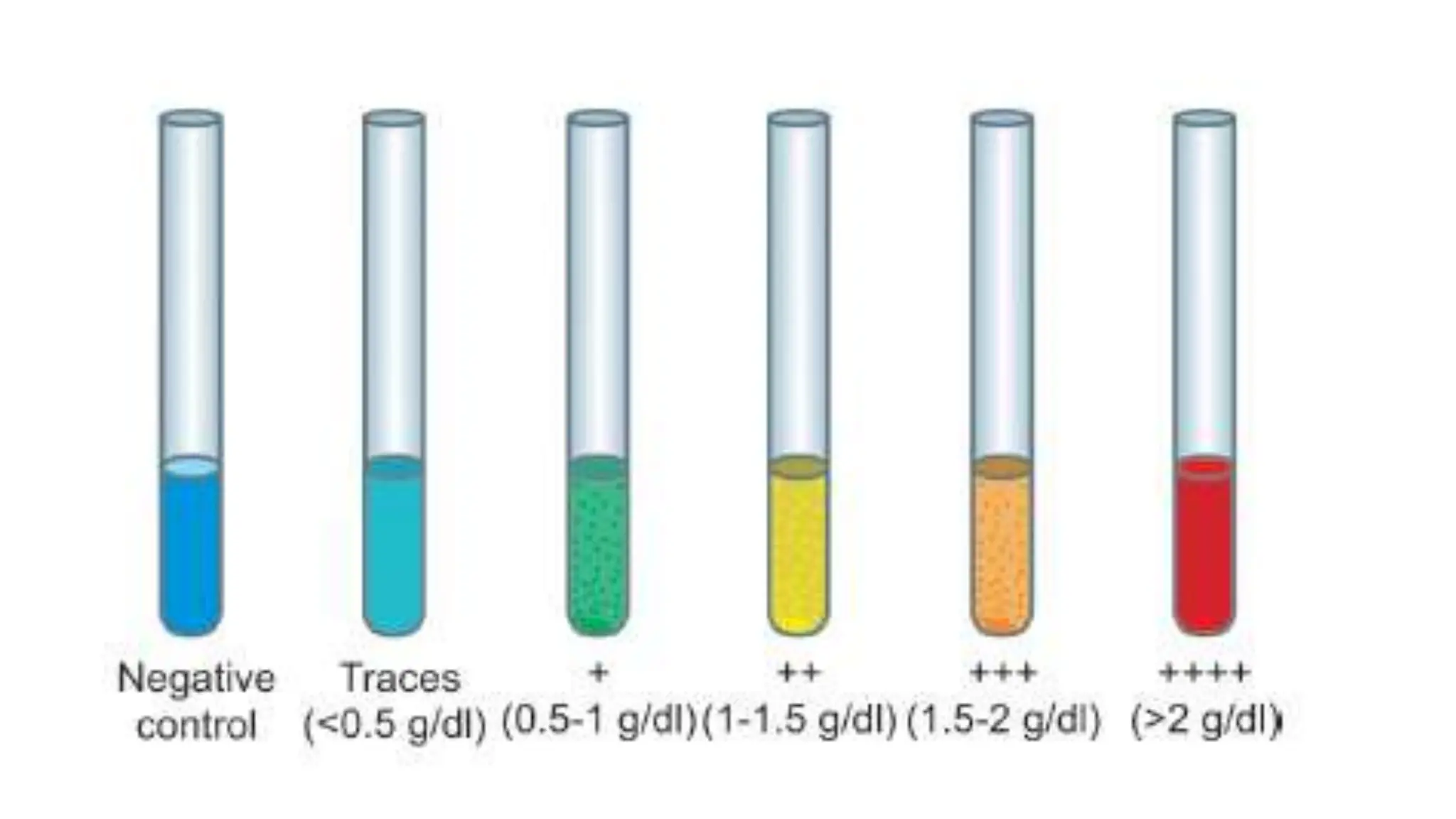 Urine analysis - Reducing Sugar | PPT