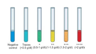 Urine analysis - Reducing Sugar | PPT