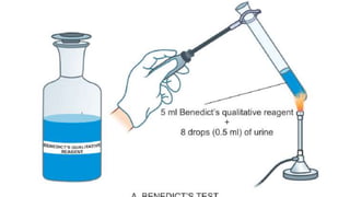 Urine analysis - Reducing Sugar | PPT