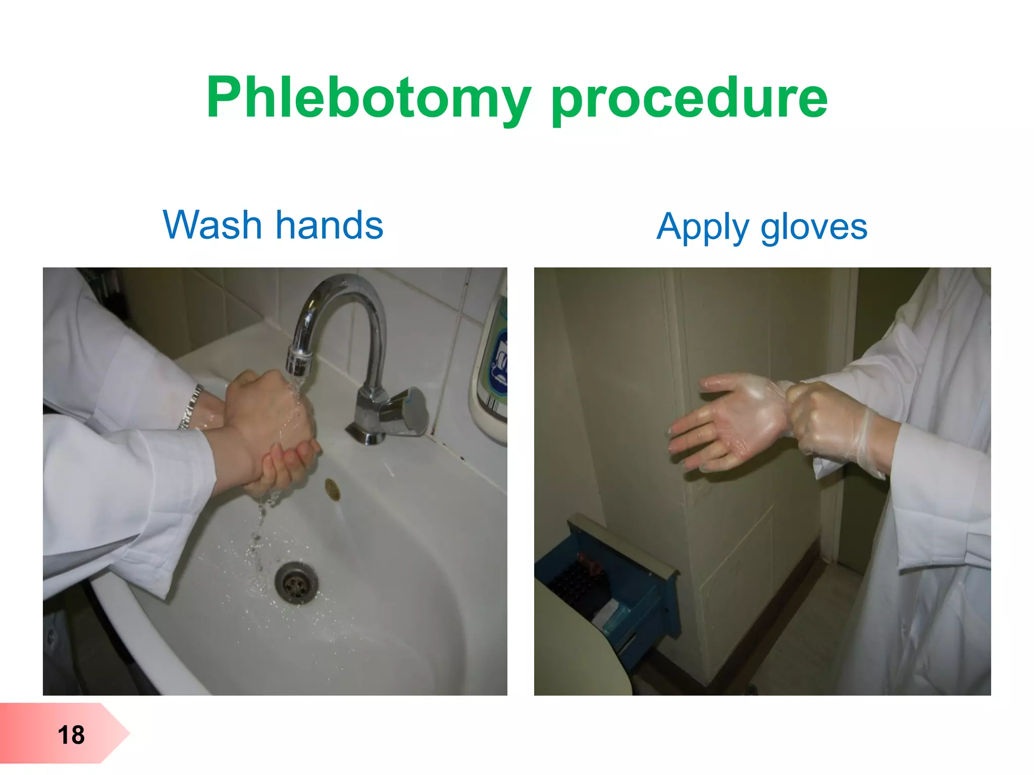 Blood collection, handling, and anticoagulants | PDF