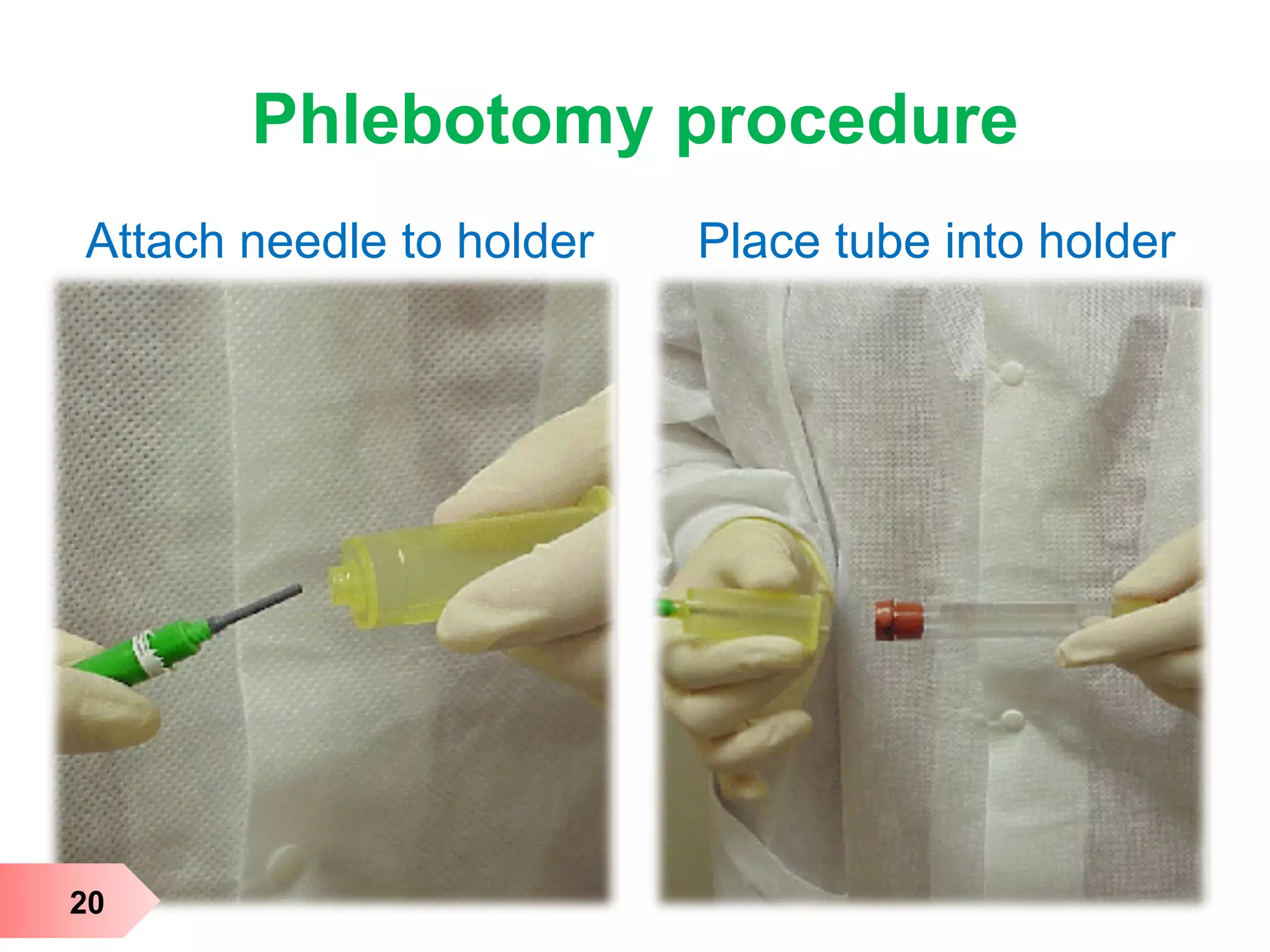 Blood collection, handling, and anticoagulants | PDF