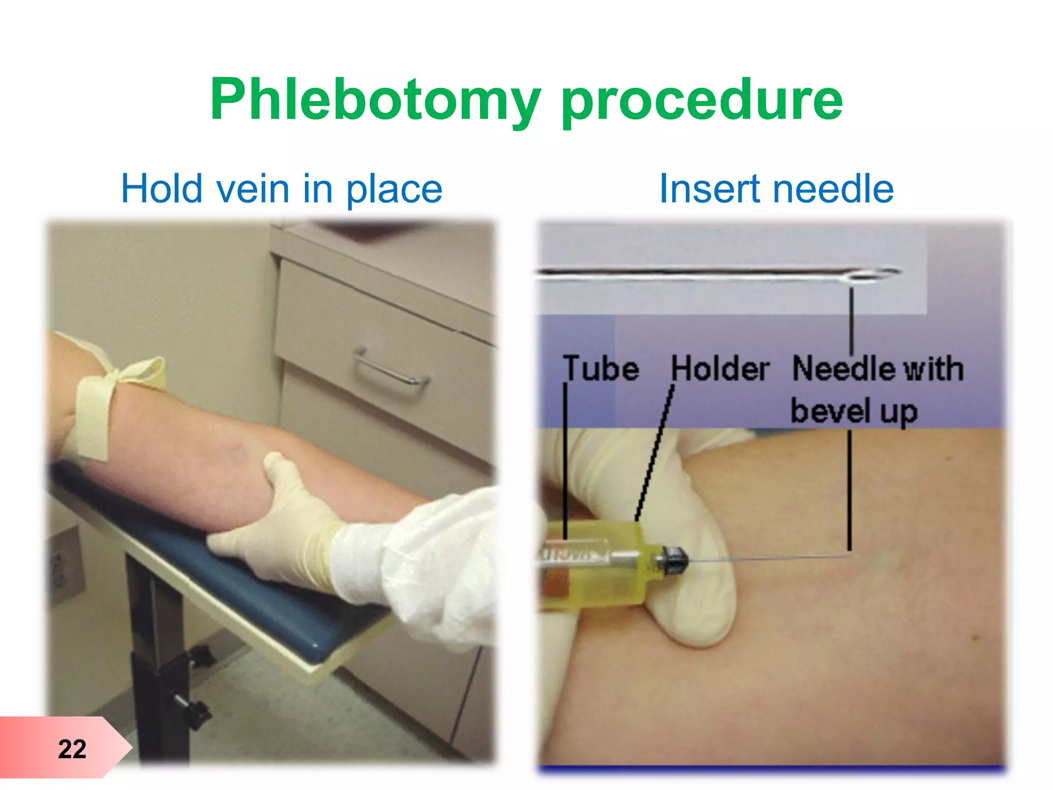 Blood collection, handling, and anticoagulants | PDF