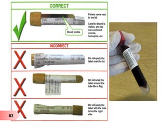 Blood collection, handling, and anticoagulants | PDF