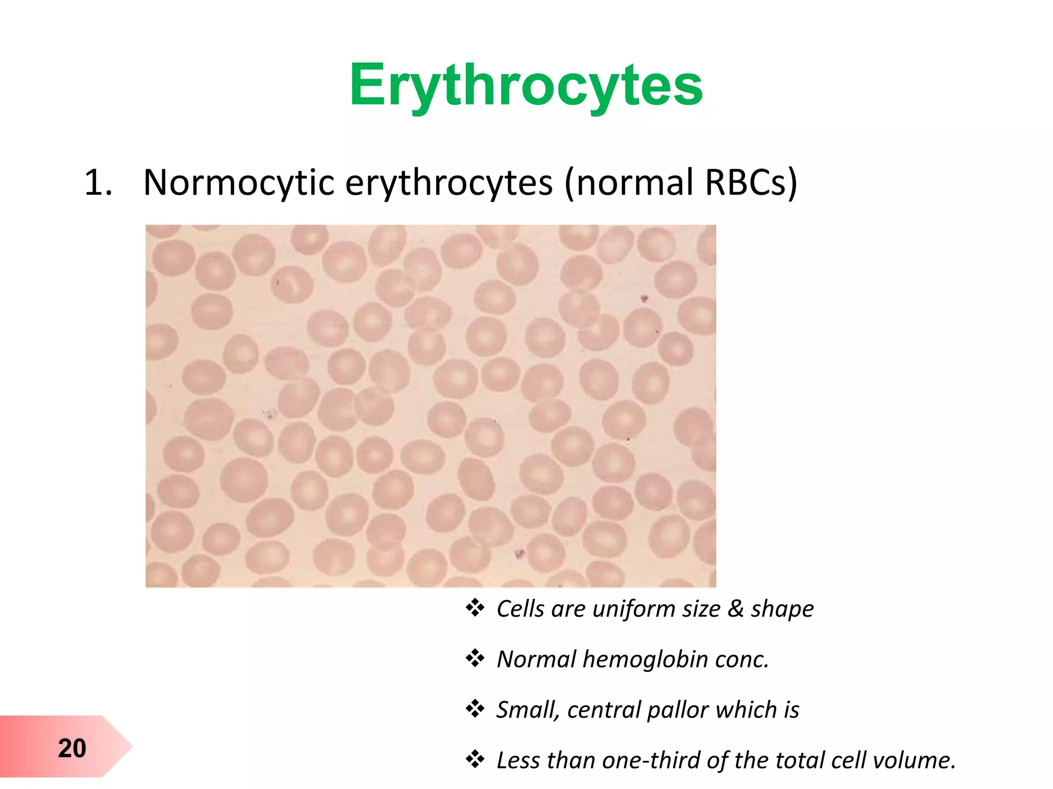 Hemoglobin estimation | PDF