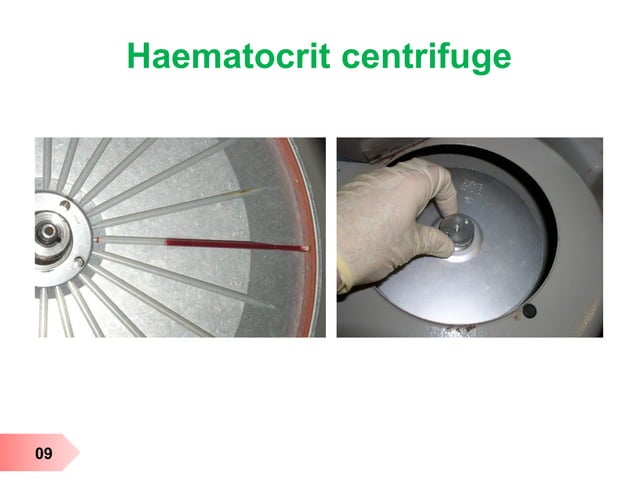 Hematocrit determination | PDF