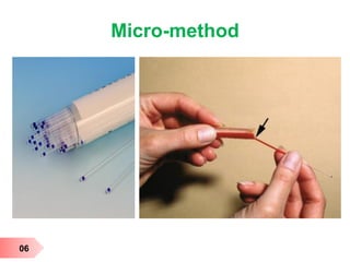 Hematocrit determination | PDF