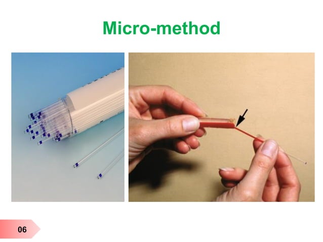 Hematocrit determination | PDF
