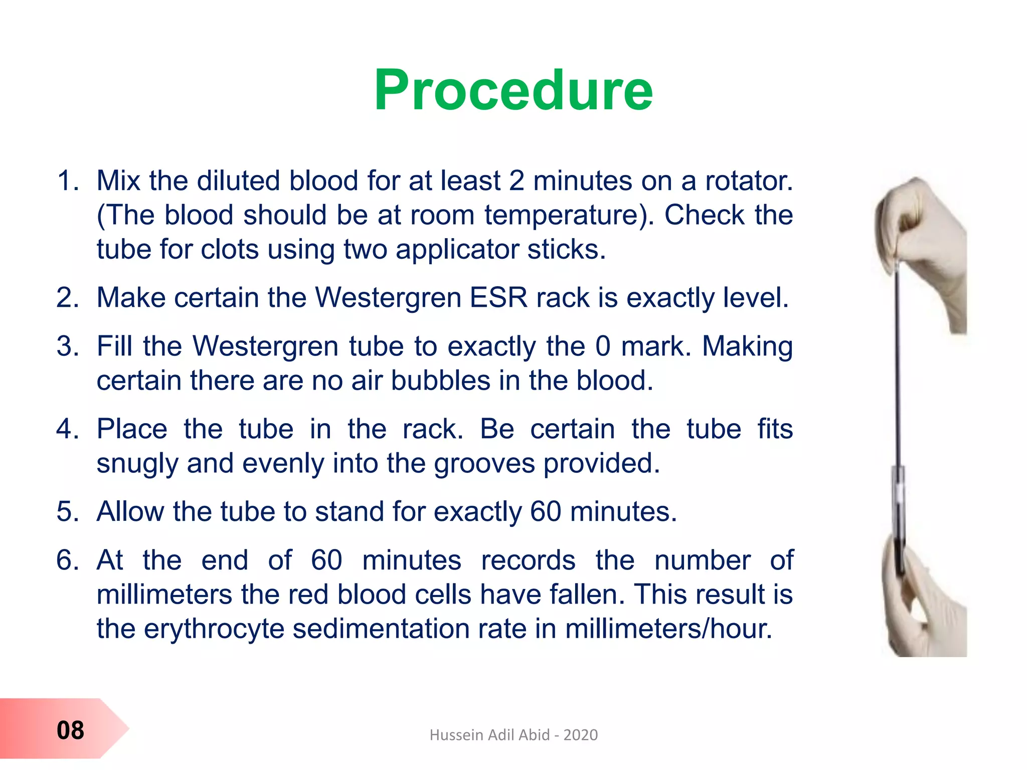 Erythrocyte Sedimentation Rate (ESR) | PDF