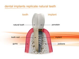 Mlv131 rev c patient education presentation | PPTX