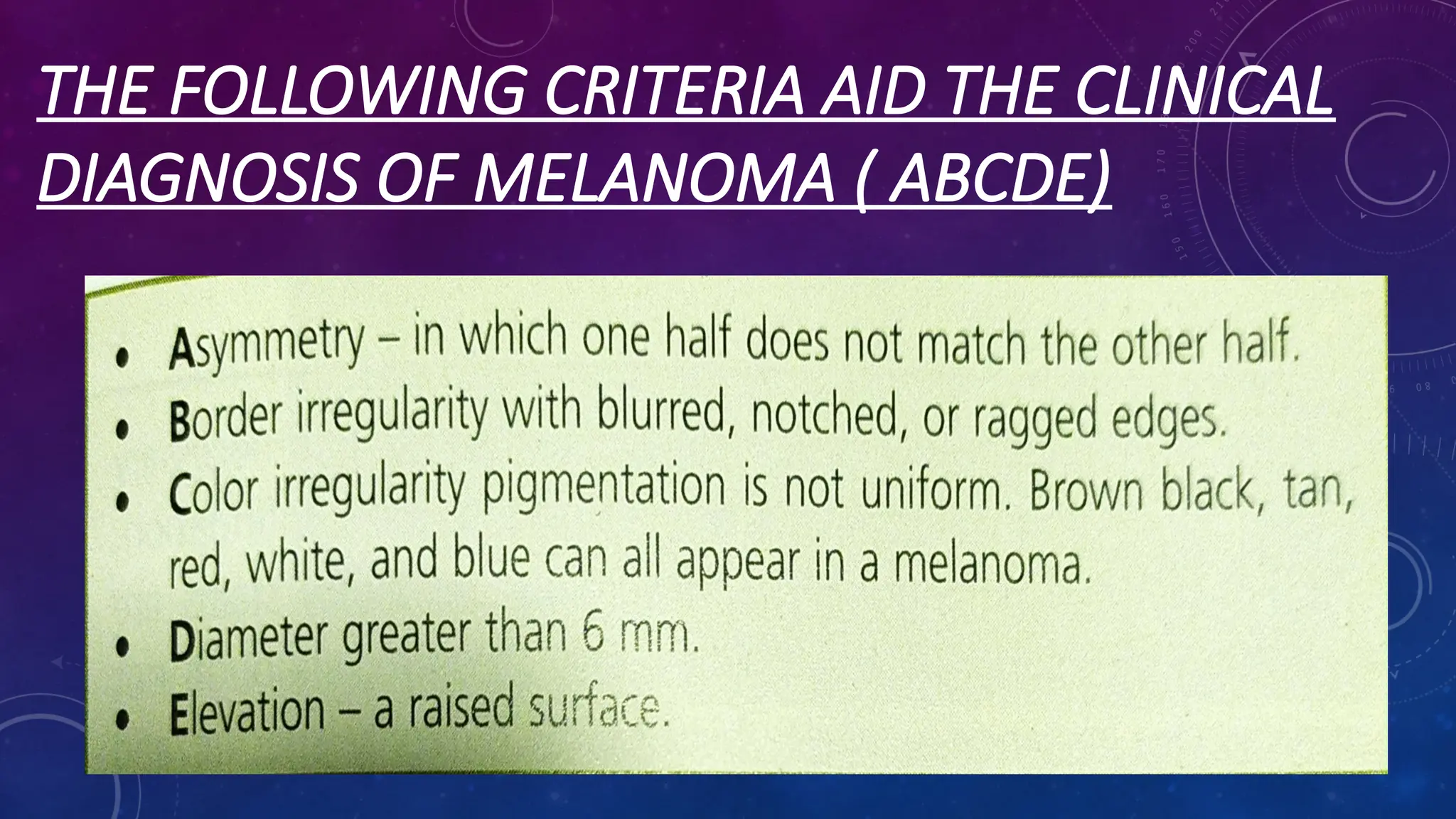 Bds 3rd Malignant melanoma.ppt