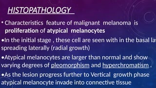 Bds 3rd Malignant melanoma.ppt