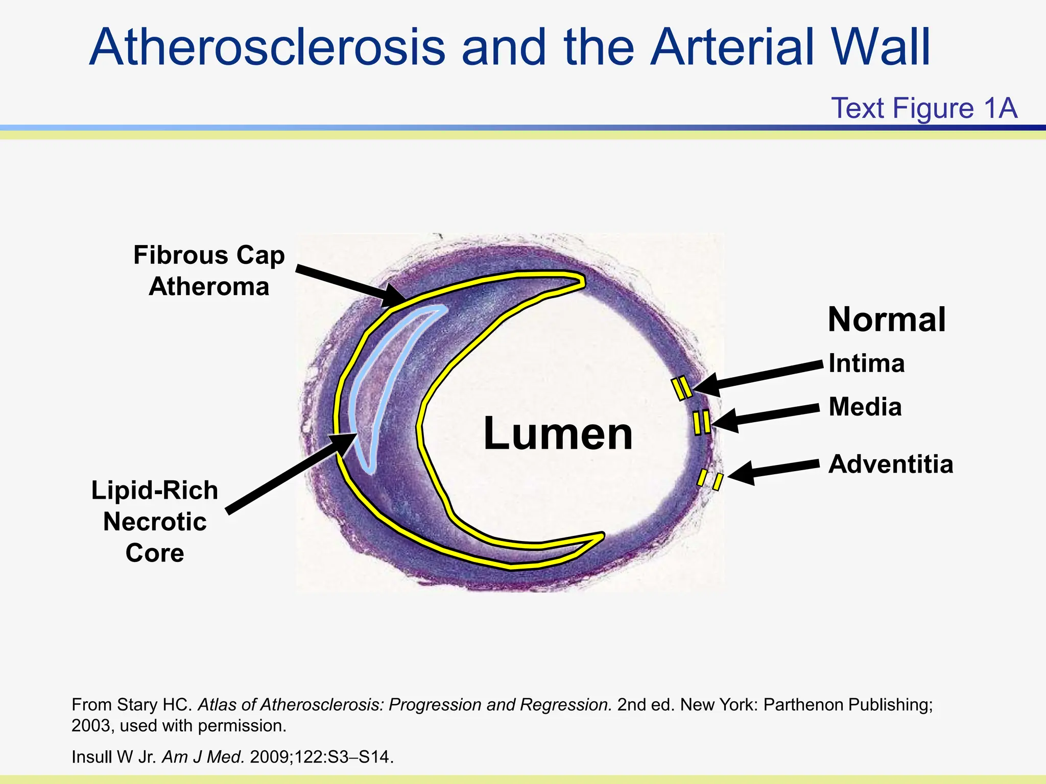 Pathogenesis of atherosclerosis mmc1.ppt