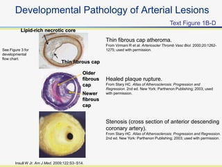 Pathogenesis of atherosclerosis mmc1.ppt