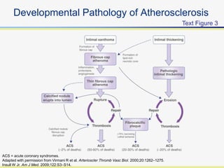 Pathogenesis of atherosclerosis mmc1.ppt