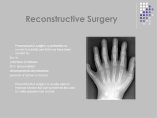 0854746 Plastic Surgery | PPT