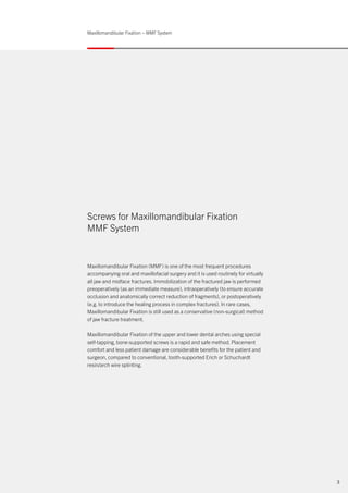 Mmf system | PDF