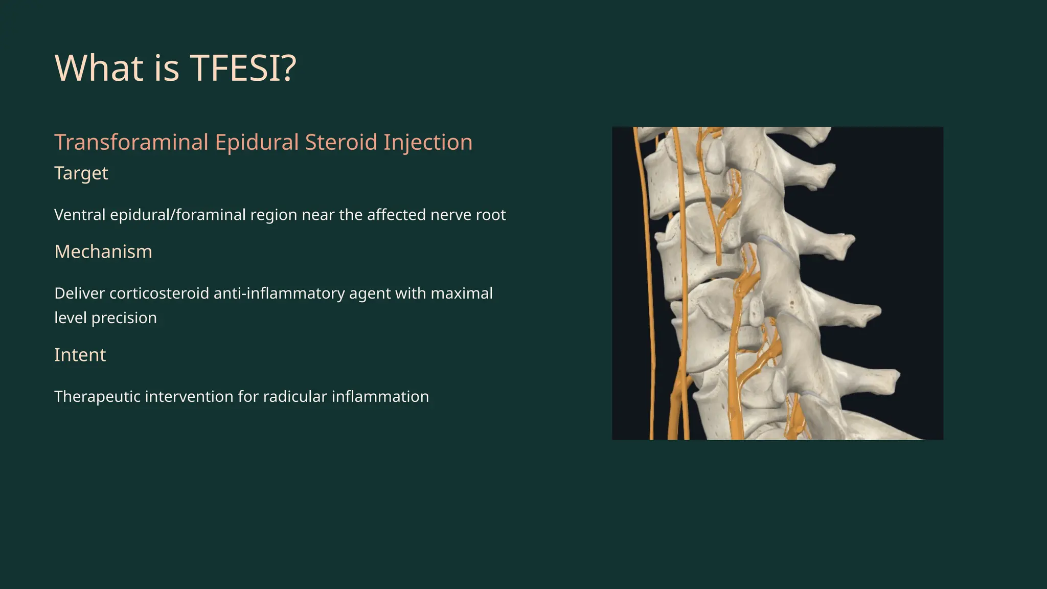TFESI vs Interlaminar Epidural vs Selective Nerve Root Block vs Distal ...