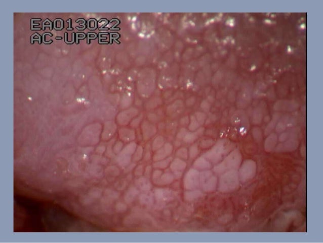 3 prof walter colposcopic