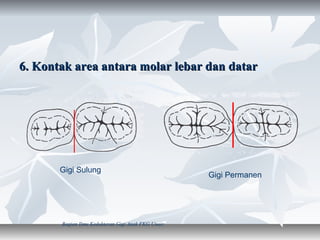Mmp morfologi gigi sulung | PPT
