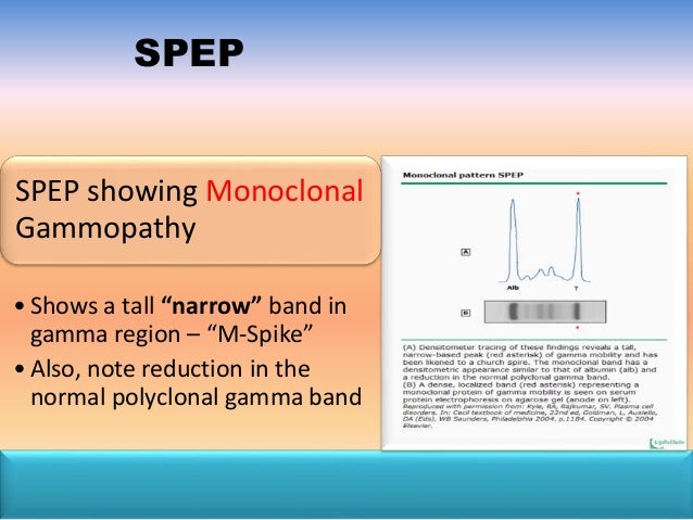 Multiple Myeloma
