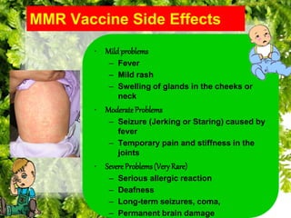 MMR vaccine | PPTX
