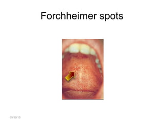 Forschheimer Spots