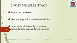MEASLES MUMPS RUBELLA, PPT FOR EDUCATION | PPTX