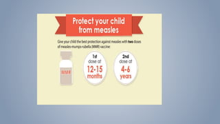 MMR VACCINE PPT.pptx