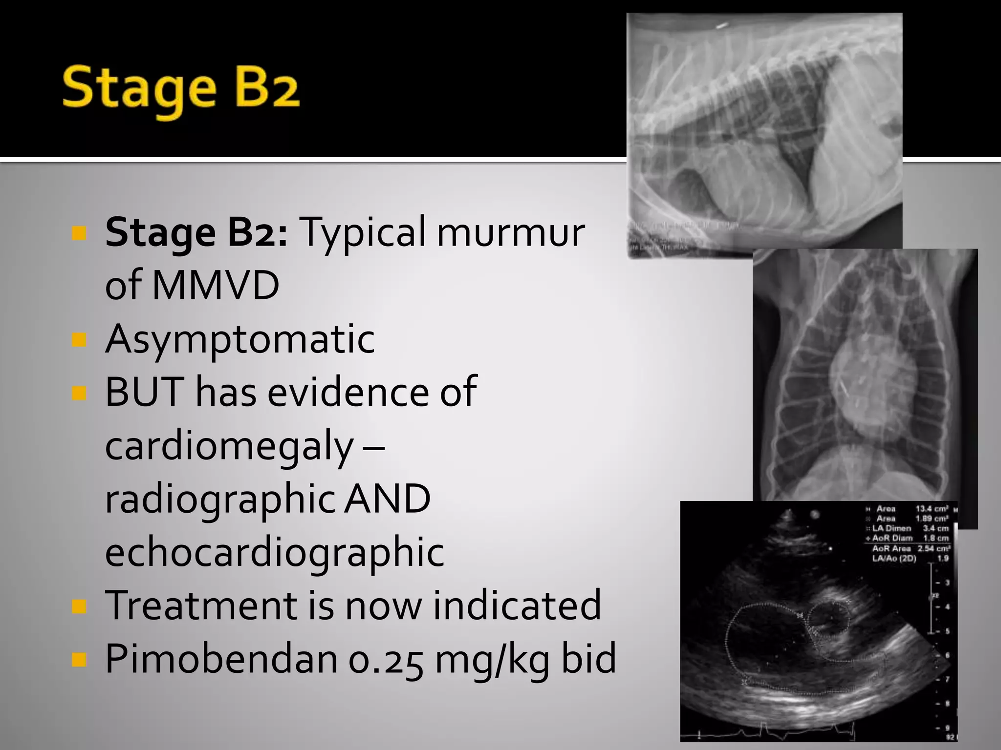 Cardiology - Myxomatous Mitral Valve Degeneration: What's New? By Rita ...