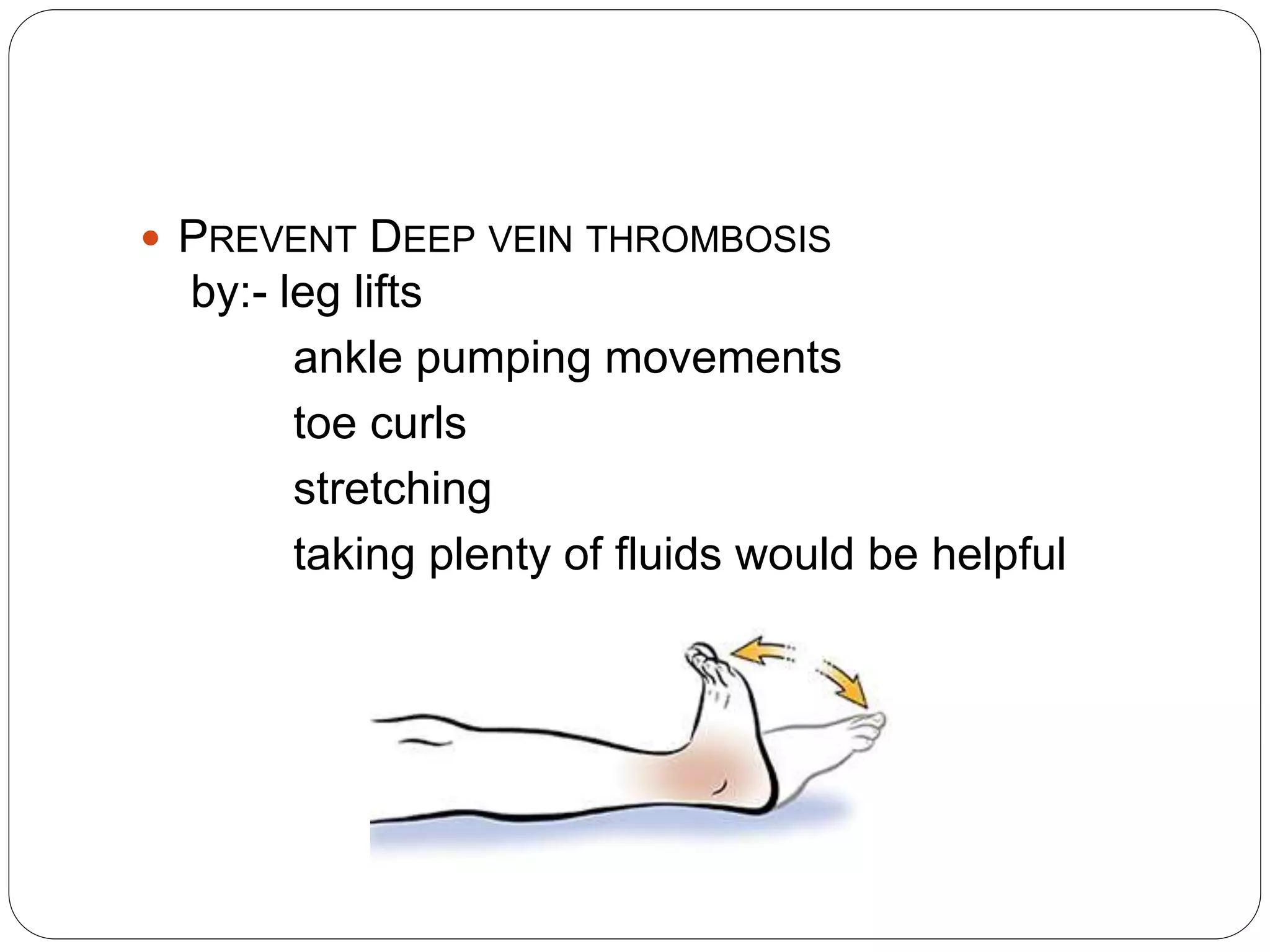 MND assessment and management | PPTX