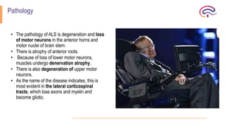 Motor neuron diseases | PPTX