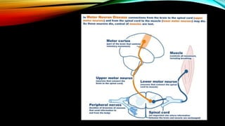 Motor Neuron Disease | PPT