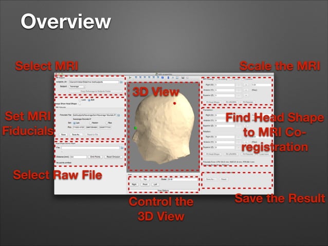 MNE-Python Coregistration | PPT