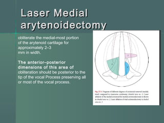 management of b/l vocal cord paralysis | PPT