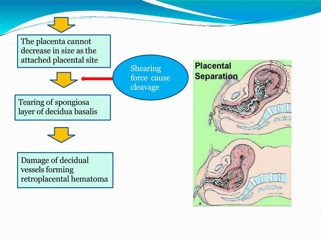 Management of 3rd stage of labor | PPTX