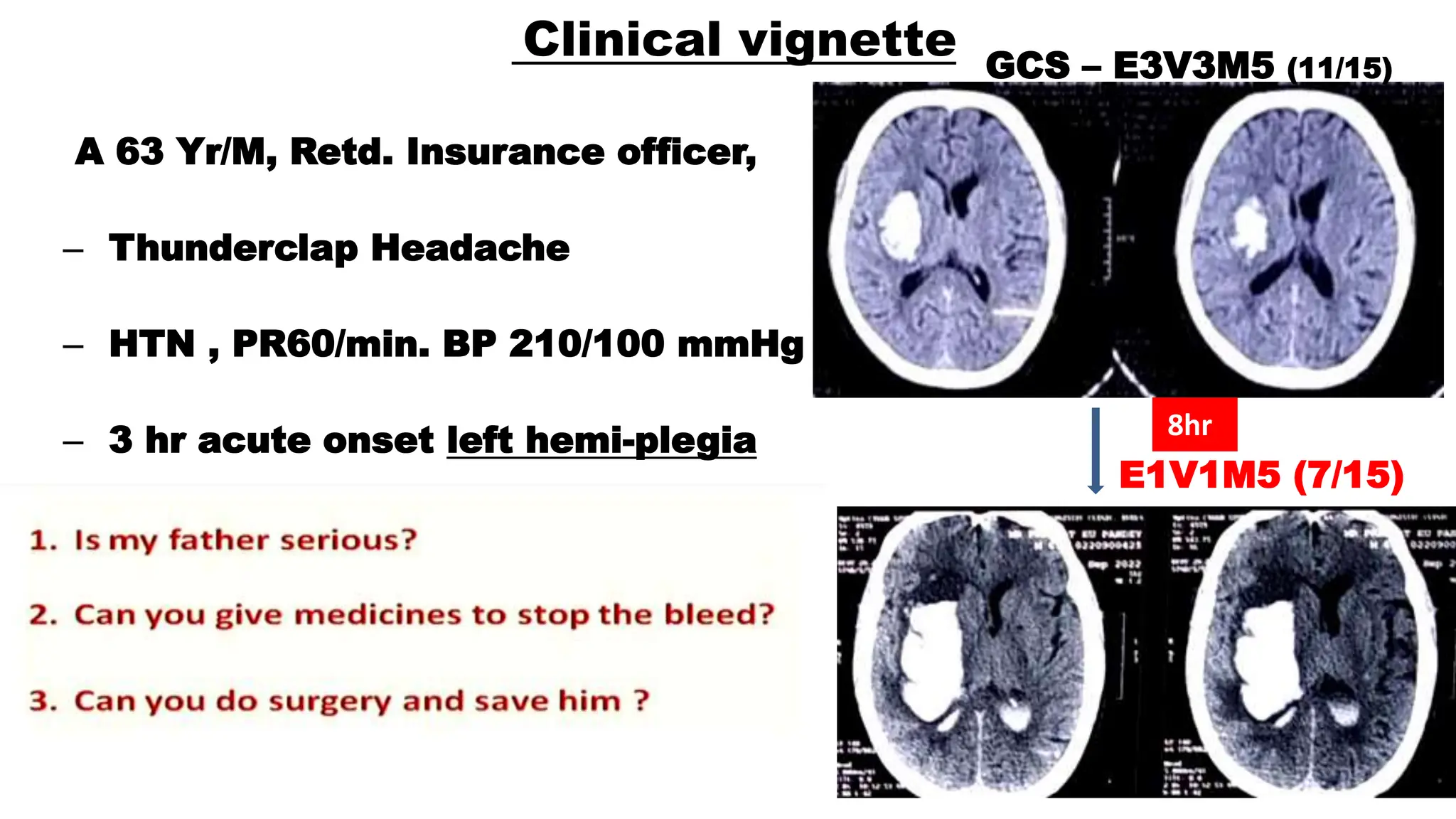 MANAGEMENT OF CEREBROVASCULAR ACCIDENT.pptx