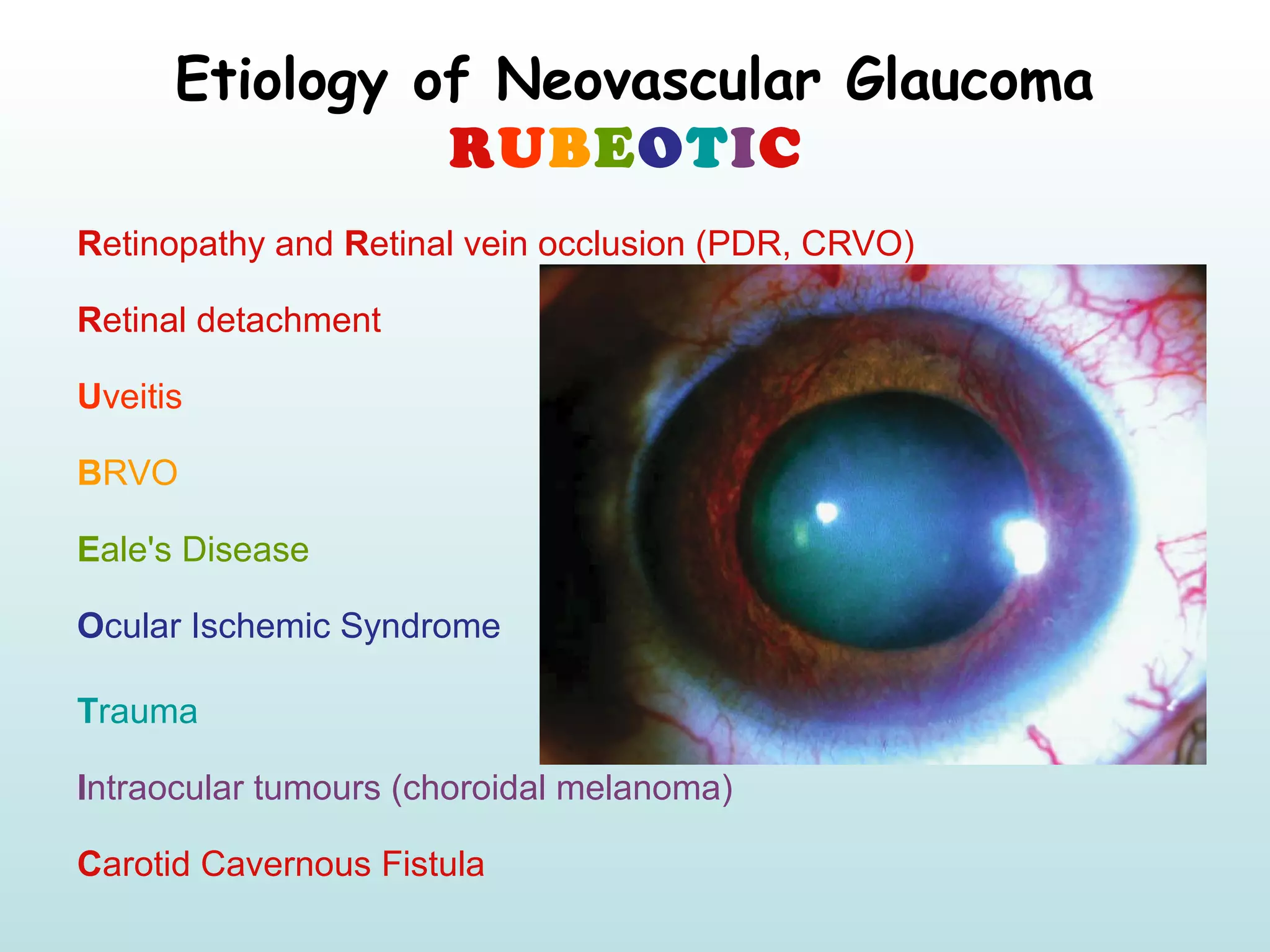 Mnemonics of Ophthalmology | PPT