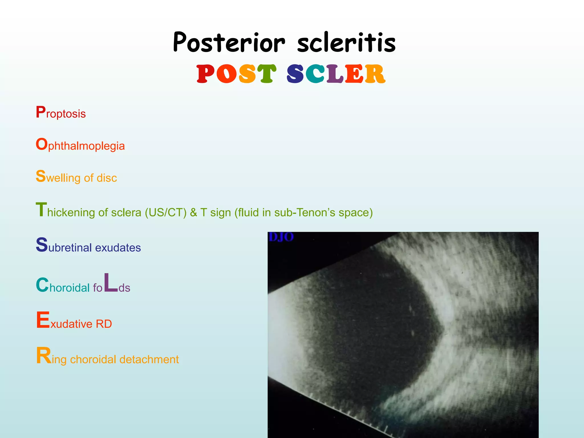 Mnemonics of Ophthalmology | PPT