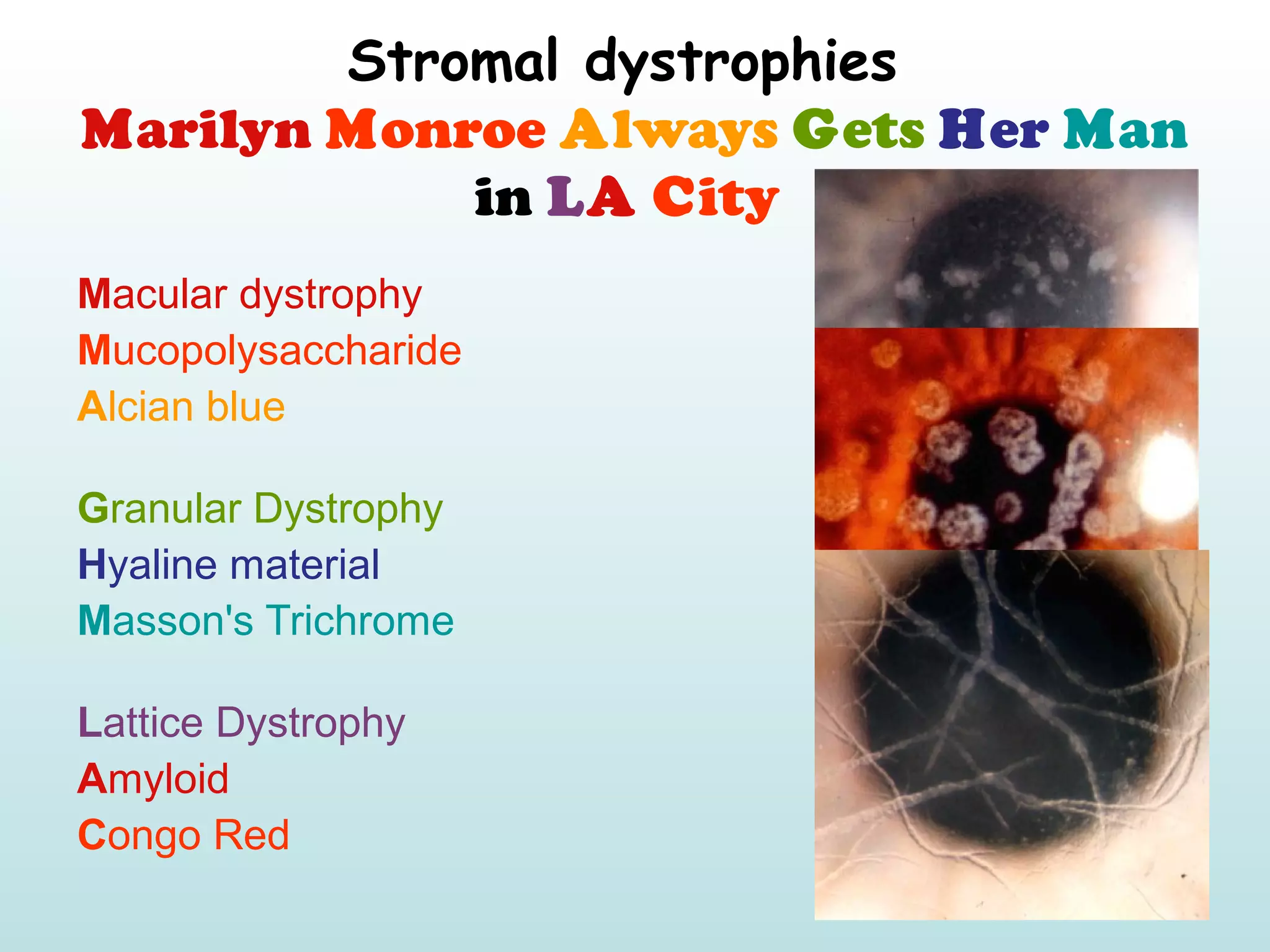 Mnemonics of Ophthalmology | PPT