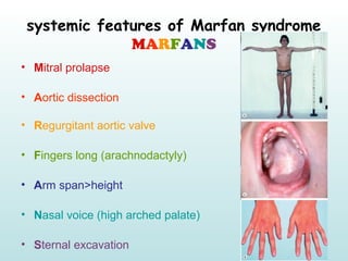 Mnemonics of Ophthalmology | PPT