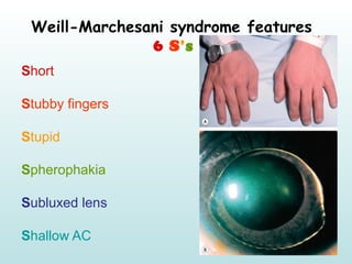 Mnemonics of Ophthalmology | PPT