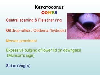 Mnemonics of Ophthalmology | PPT