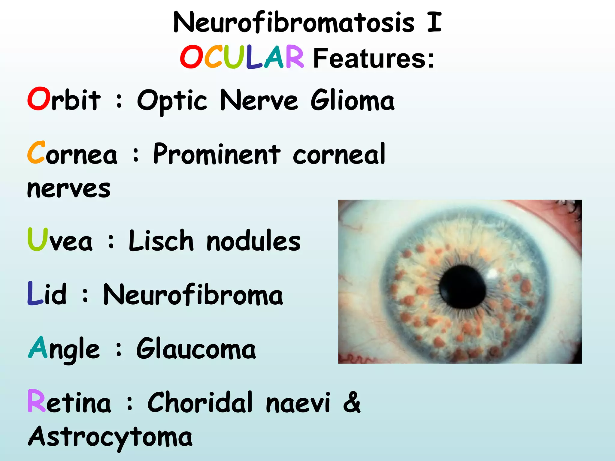 Mnemonics of Ophthalmology II | PPT