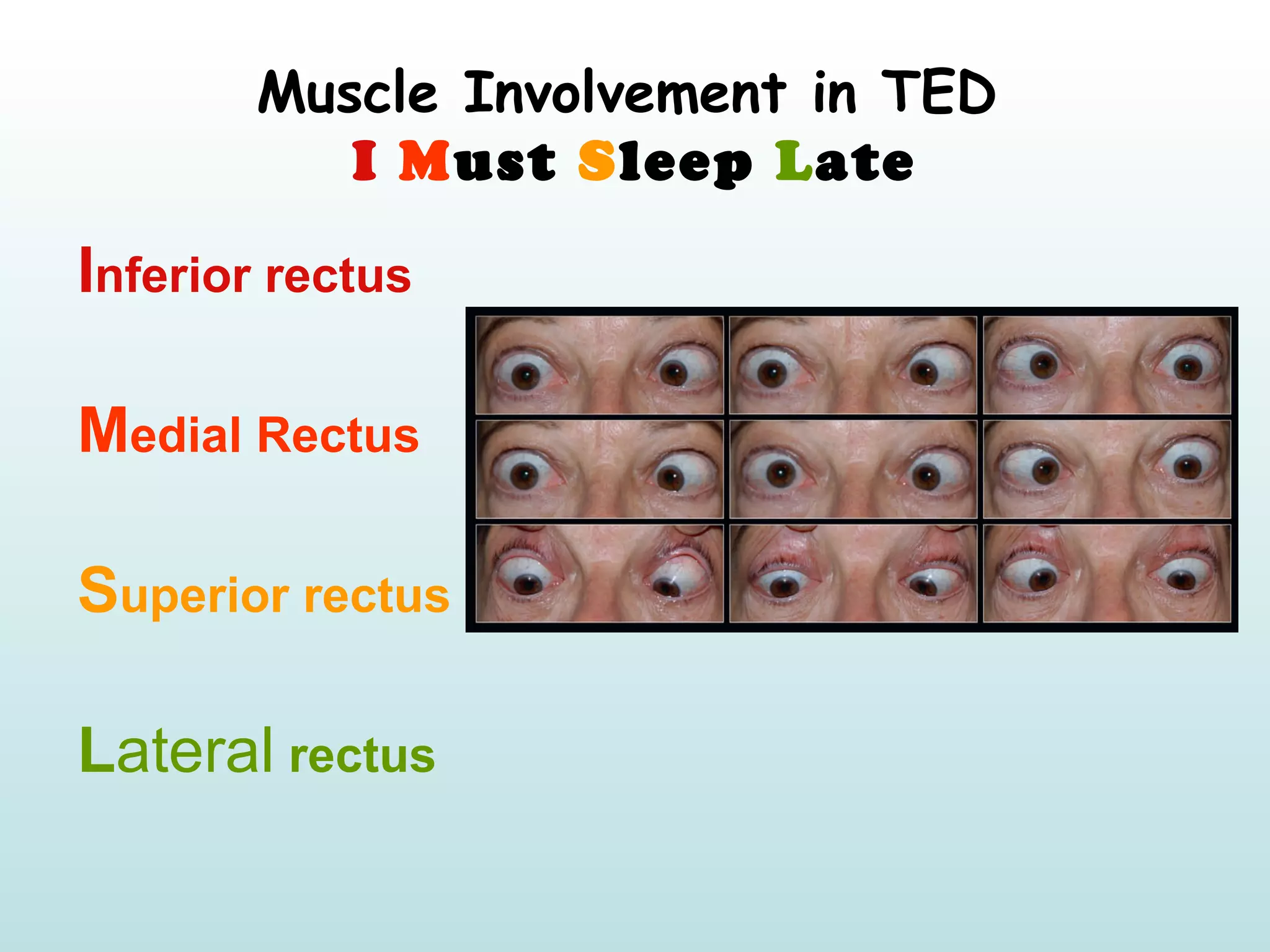 Mnemonics of Ophthalmology II | PPT