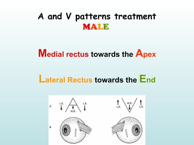 Mnemonics of Ophthalmology II | PPT | Eye and Vision Conditions ...