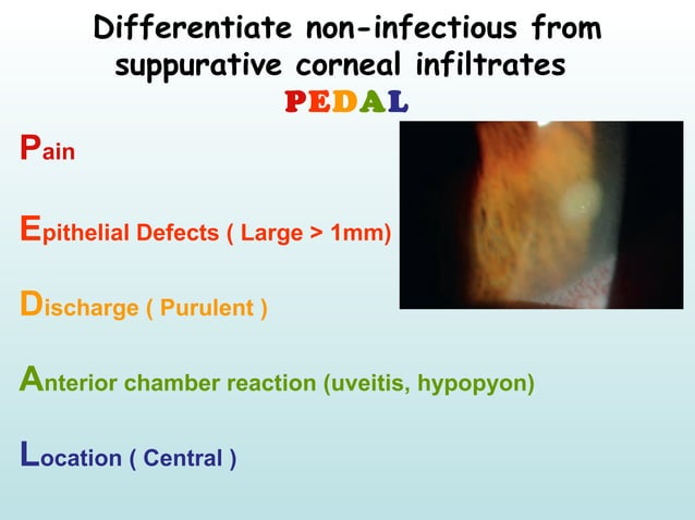 Mnemonics of Ophthalmology II | PPT | Eye and Vision Conditions ...