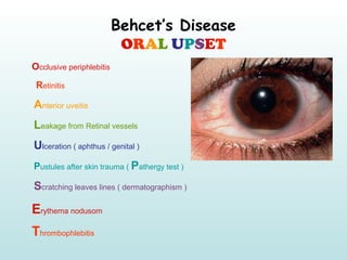 Mnemonics of Ophthalmology II | PPT